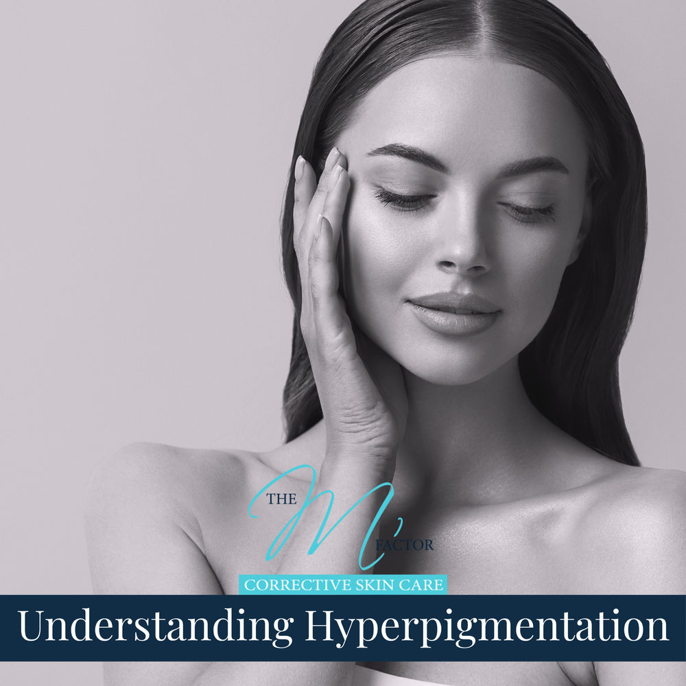 Understanding Hyperpigmentation