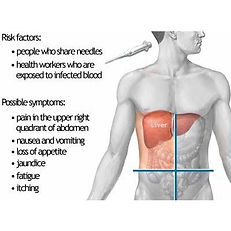 Hepatitis | Atlanta, GA | Atlanta Center for Gastroenterology