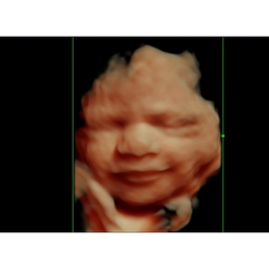 3D/4D Ultrasound Machines For Sale | We Price Match!