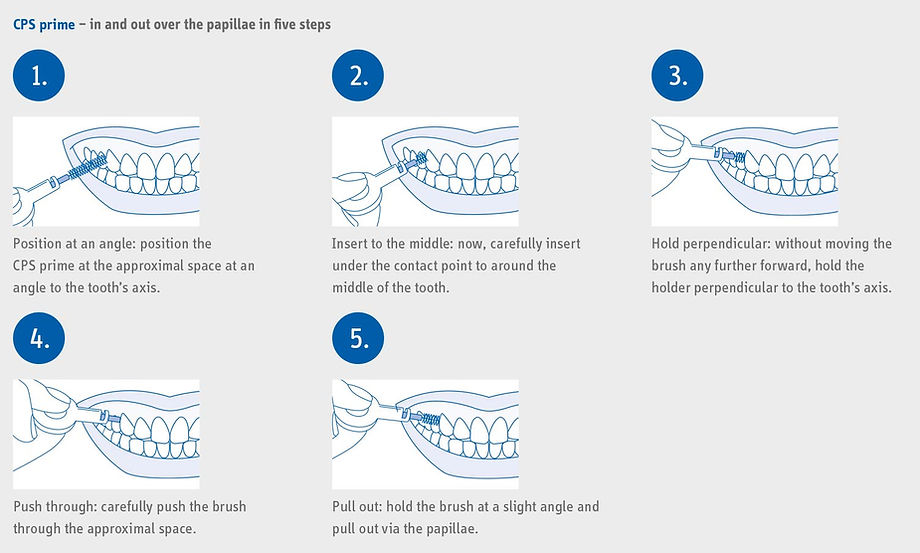Interdental info Pharmapal Interdental info Pharmapal