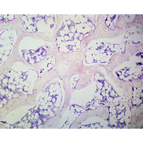 Spongy Bone Section Microscope Slide | Science Outside