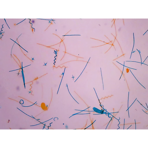 Unprocessed Pond Water Sample Microscope Slide | Science Outside