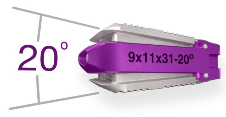 Nuvasive TLX. Interbody Fusion Device. Lumbar/T-Lumbar. Non-Bone ...