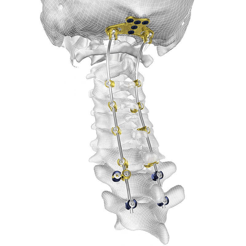 CoreLink TIGER® Occipital Cervical Thoracic System. Catalog #35945-40