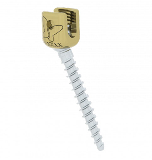 SpineArt ROMEO. Lumbar Pedicle Screw System. SET SCREW. Two-Level ...