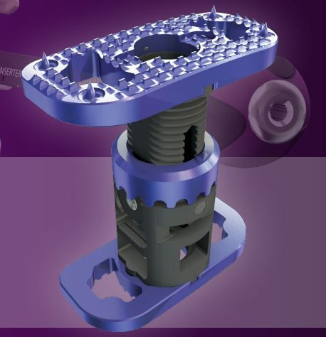 NuVasive X-CORE 2. Expandable Corpectomy Device. CORE. Catalog #7160025