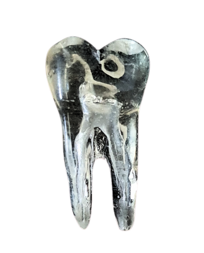 EndoClear 4 CANAIS 37 | Biom 3D