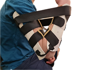 Fracture Rehabilitation | Centre for Advanced Rehabilitation