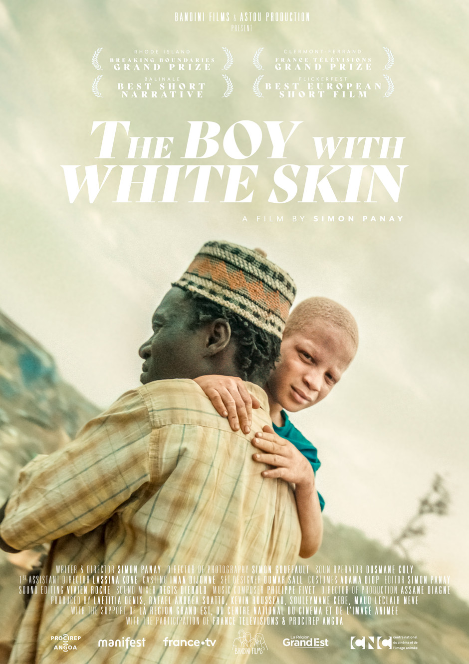 The Boy with White Skin | Short film
