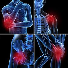 Bursite: Causas e Tratamento