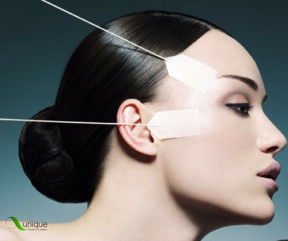 Shadow Lifting: conheça a técnica de lifting não cirúrgico criada pelo ...