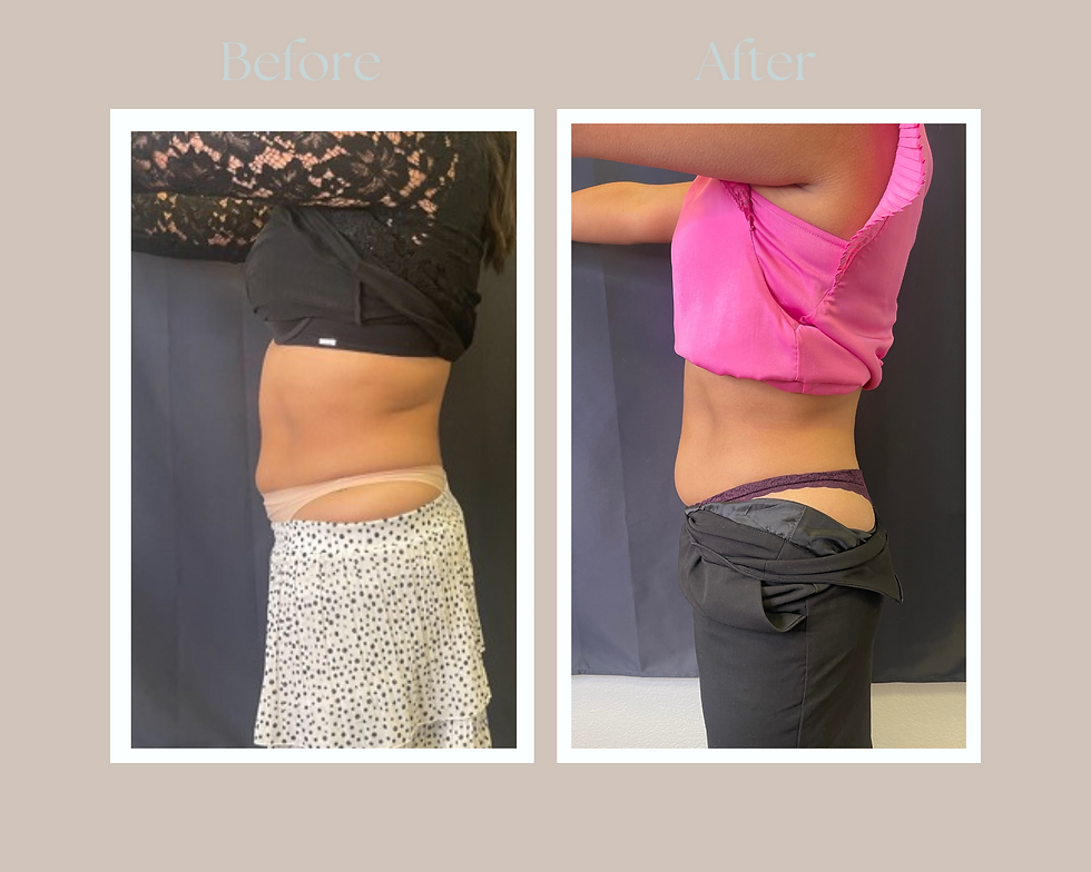 Part 2 Journey to Confidence with LightRx Face and Body MedSpa