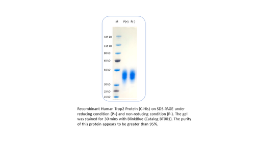 Human TROP-2 Protein (C-His) | BioTimes