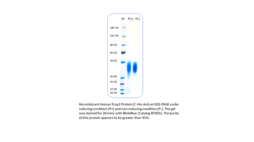 Human TROP-2 Protein (C-His-Avi) | BioTimes