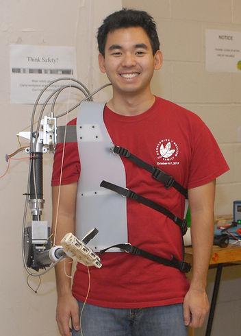 Prosthetic Arm | kellenchow