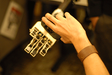 Prosthetic Arm | kellenchow