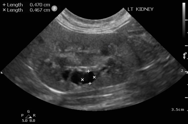 Kidney Polycystic Feline Ultrasound: Abdominal Cat Diagnosis