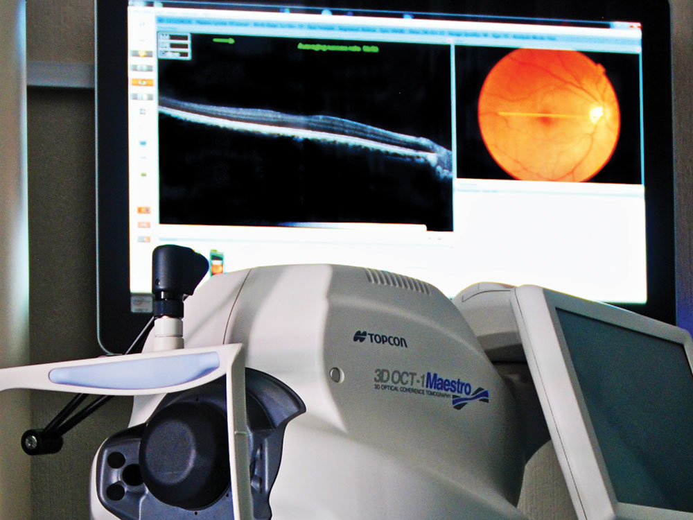 Enhanced Eye Examinations At Flint Optometry In Wolverhampton