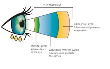 Dry Eye Clinic in Locksbottom, Kent