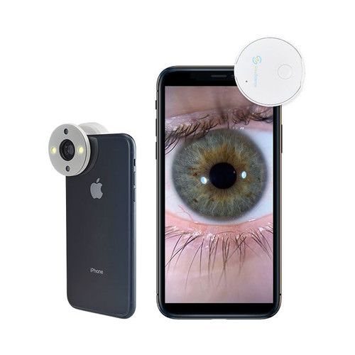 QuickVue | Oftalmica Lg