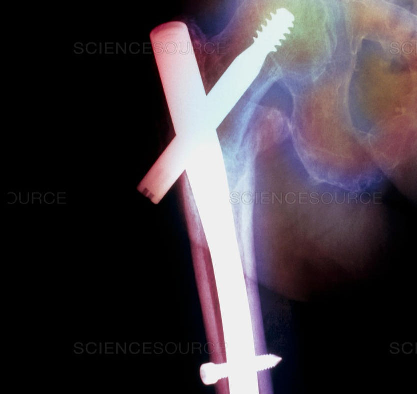 The Healing Rod of Correction