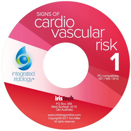Signs of the Cardio Vascular Risk | Integratediridology