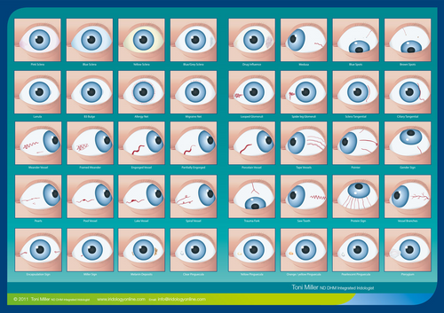 Integrated Iridology Sclera Chart - Integrated Iridology