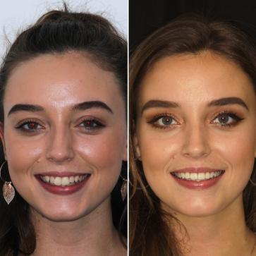 Cosmetic Orthodontics | Smile Stylist | Dentist in Manchester | Best ...