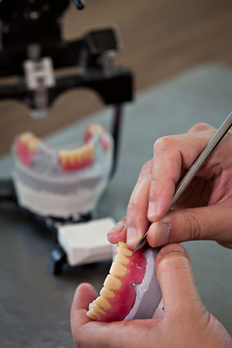 PROSTHODONTICS | Queensway Dental Lab