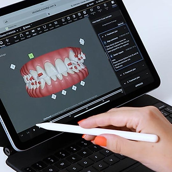 Aparat dentar Invisalign (Invizibil / Transparent) - Pret & Tratament ...