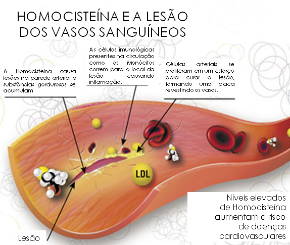 HOMOCISTEÍNA