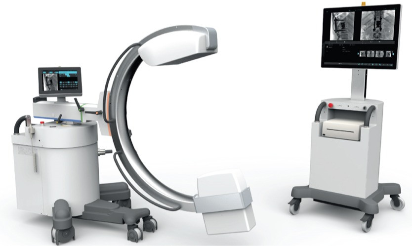 Mobile C-Arm | Products | Alpha Medical Equipment