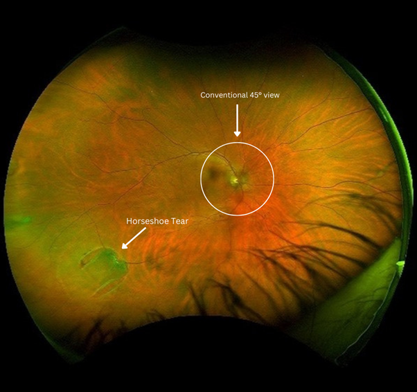 Know how to spot eye disease symptoms | The Optical Co