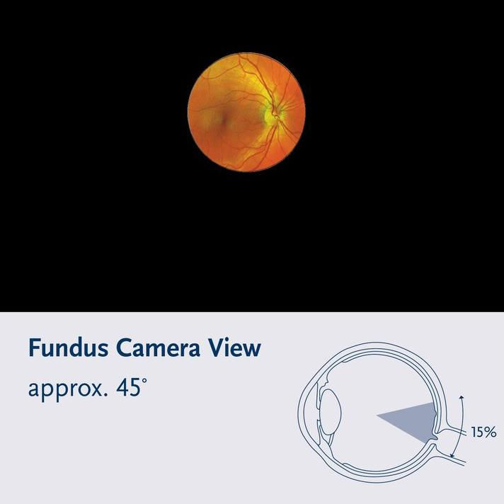 Introducing Our New Optomap Scan