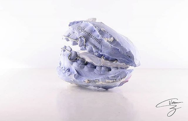 Orthodontics | Biodental Center | BInondo Manila