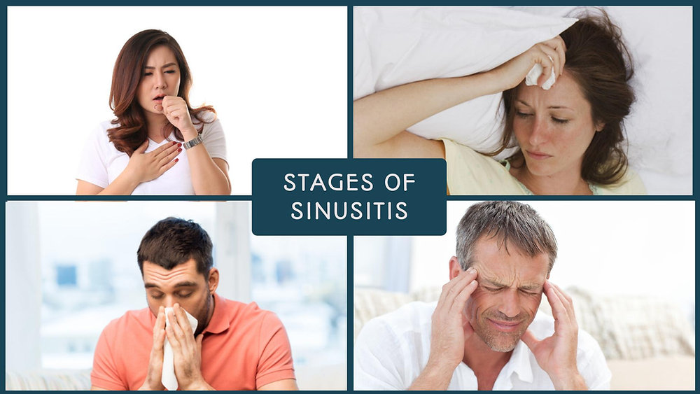 4 Stages of Sinusitis - Acute, Chronic, Subacute, Acute on Chronic