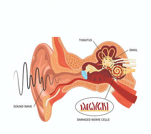 Tinnitus Treatment | Topeka ENT