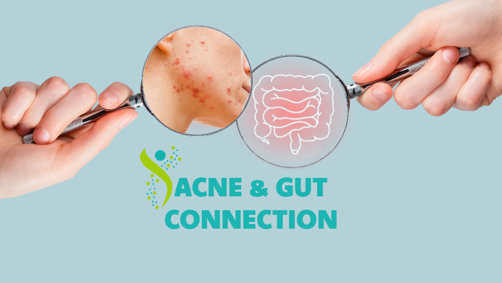 Acne and Gut Connection | MedSpa Distributors