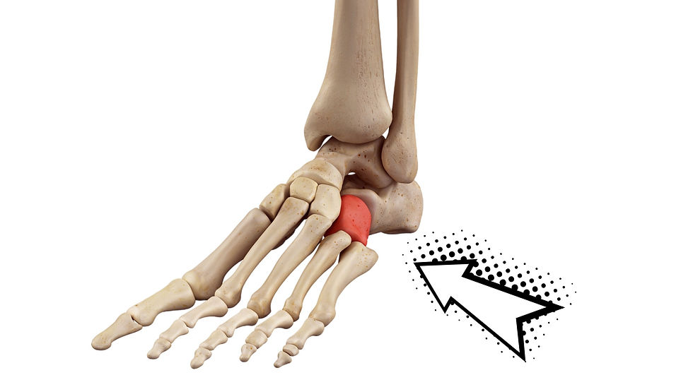 Introducing Cuboid Syndrome | Find Your Stride | Edinburgh Podiatrist
