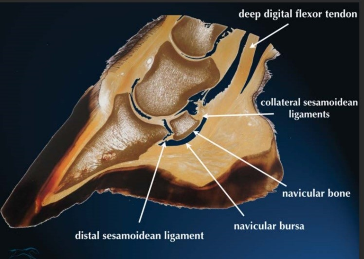 Navicular-A Retrospective Study