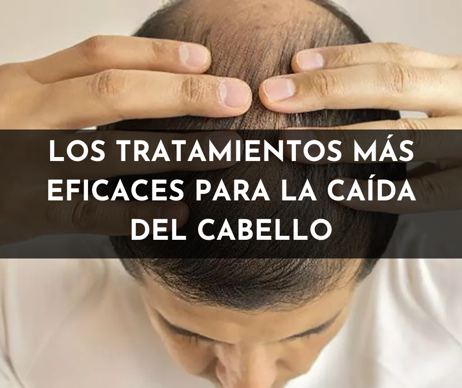 Los tratamientos más eficaces para la caída del cabello