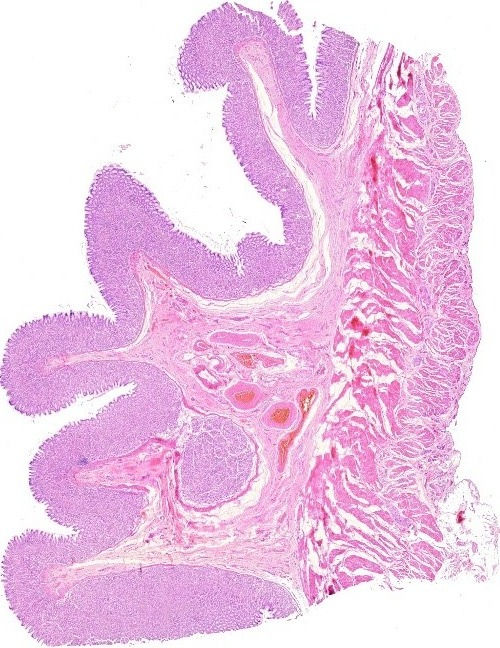 Formalin Fixed Paraffin Embedded Tissue