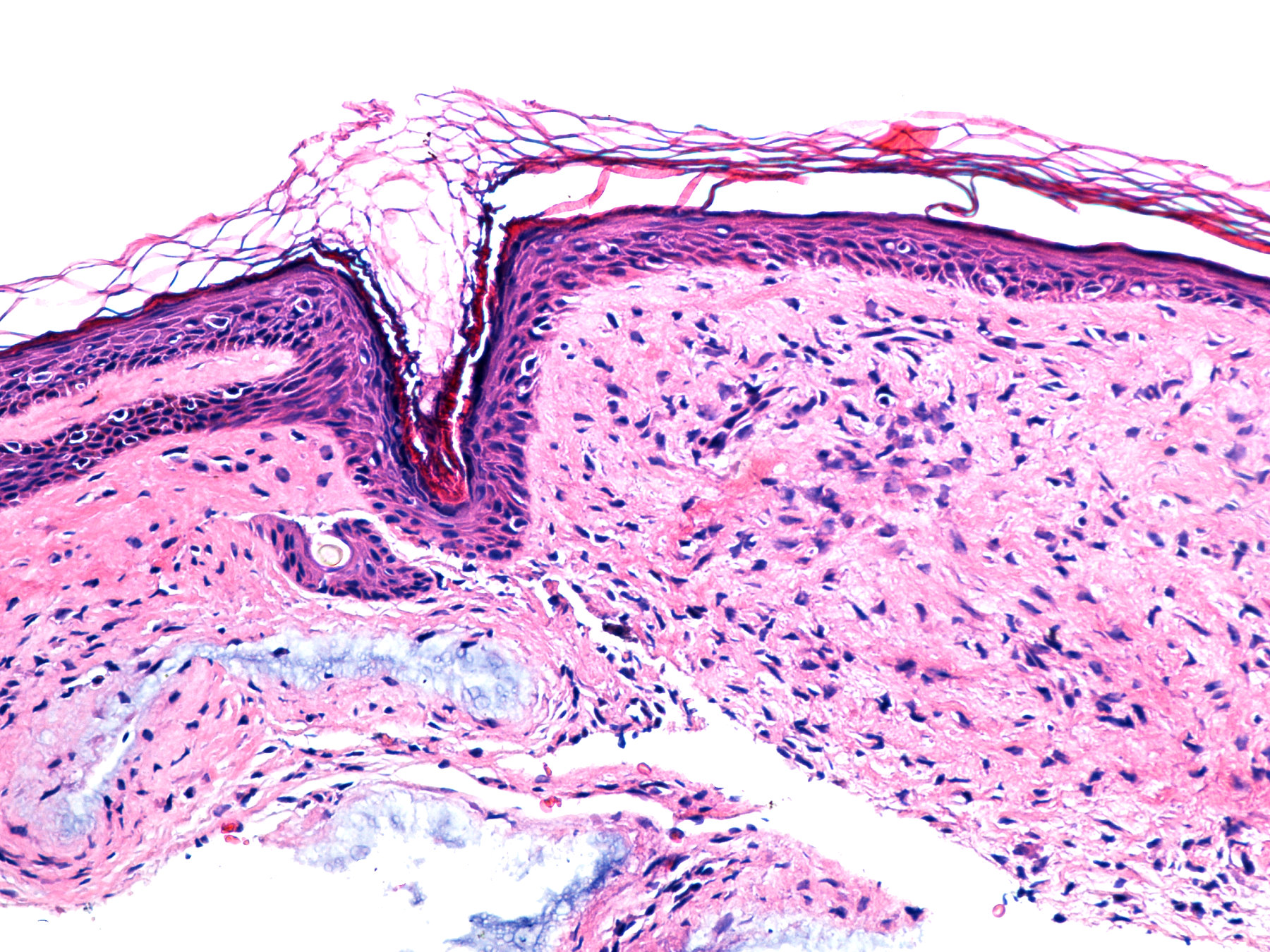 2017 Julio a Diciembre | dermatopatologia-ces