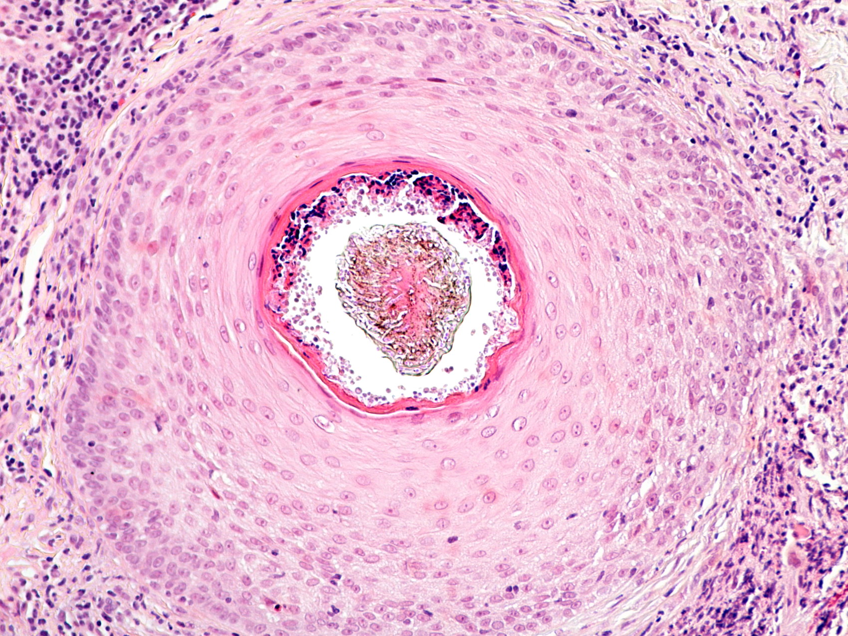 2017 Enero a Junio | dermatopatologia-ces