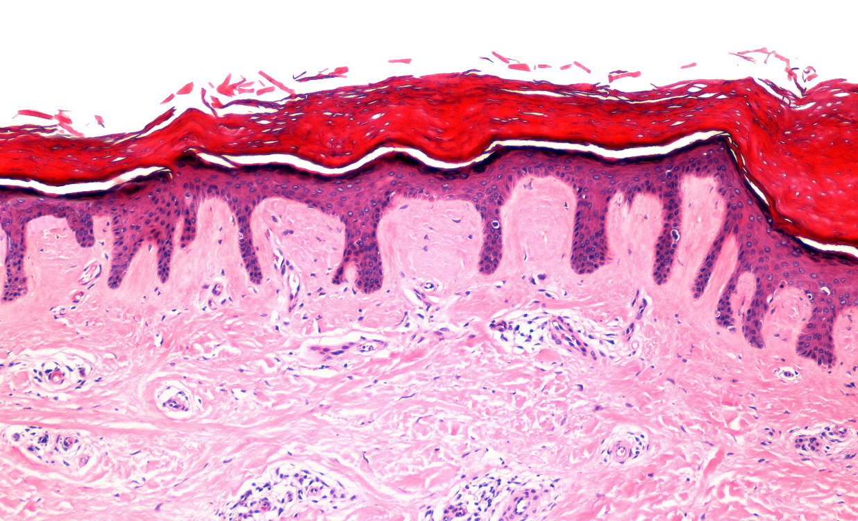 2018 Julio a Diciembre | DermatopatoCES | Medellín | Antioquia | Colom