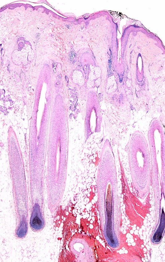 2017 Julio a Diciembre | dermatopatologia-ces