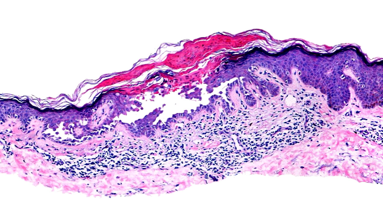 2019 Agosto a Diciembre | DermatopatoCES | Medellín | Antioquia | Col