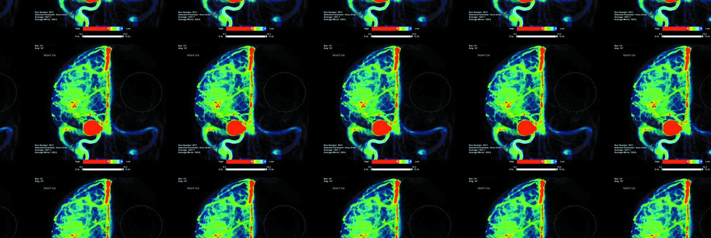 Neurosurgeon Melbourne | Monash Neurovascular Institute