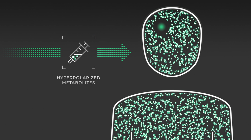 Metabolic MRI | Nvision Imaging Technologies Gmbh