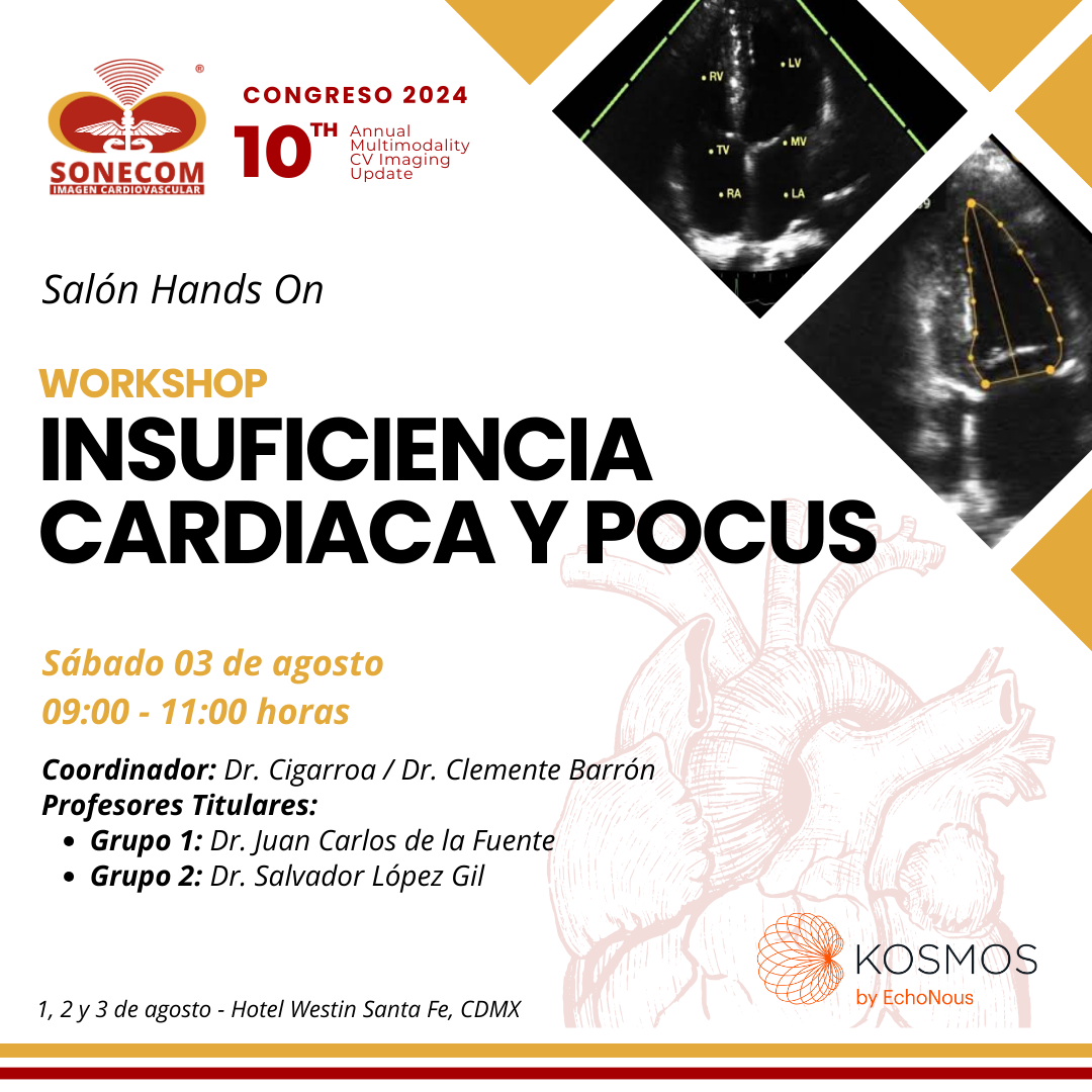 INSUFICIENCIA CARDIACA Y POCUS | SONECOM